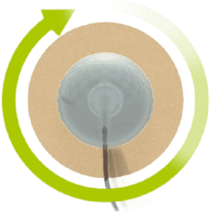 YpsoPump OrbitMICRO Infusion Set (10/box)***As per Ypsomed-there is a ...